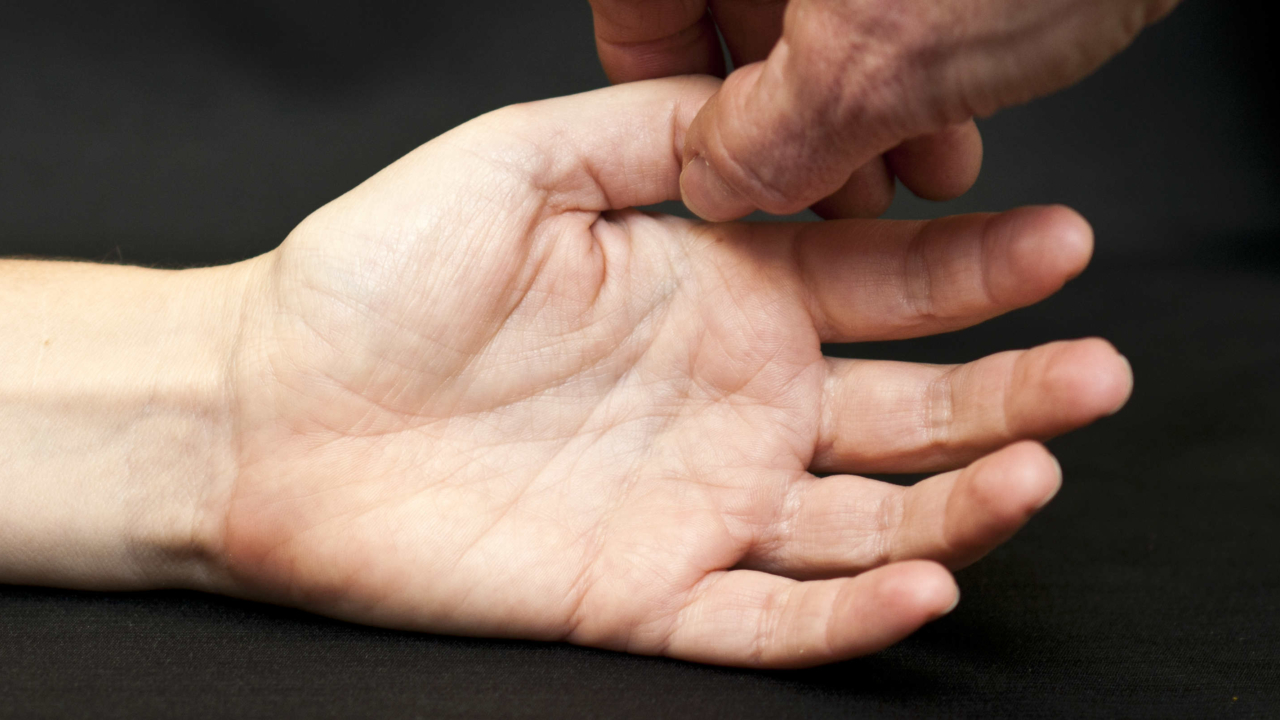 NeuRA | Stroke alters the brain’s view of the hand | Neuroscience…