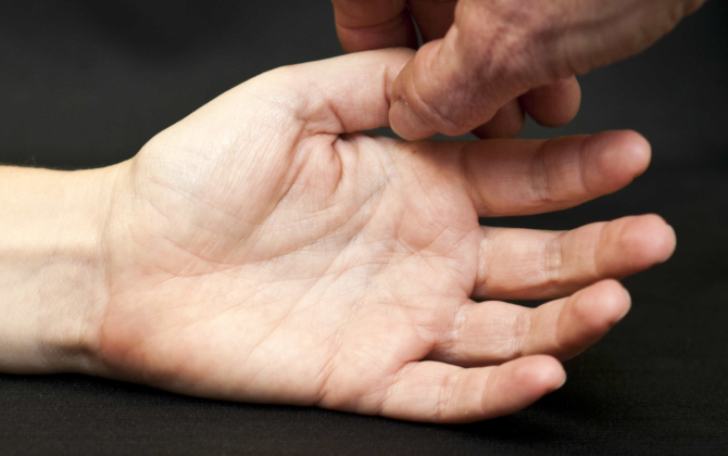 NeuRA | Stroke alters the brain’s view of the hand | Neuroscience…